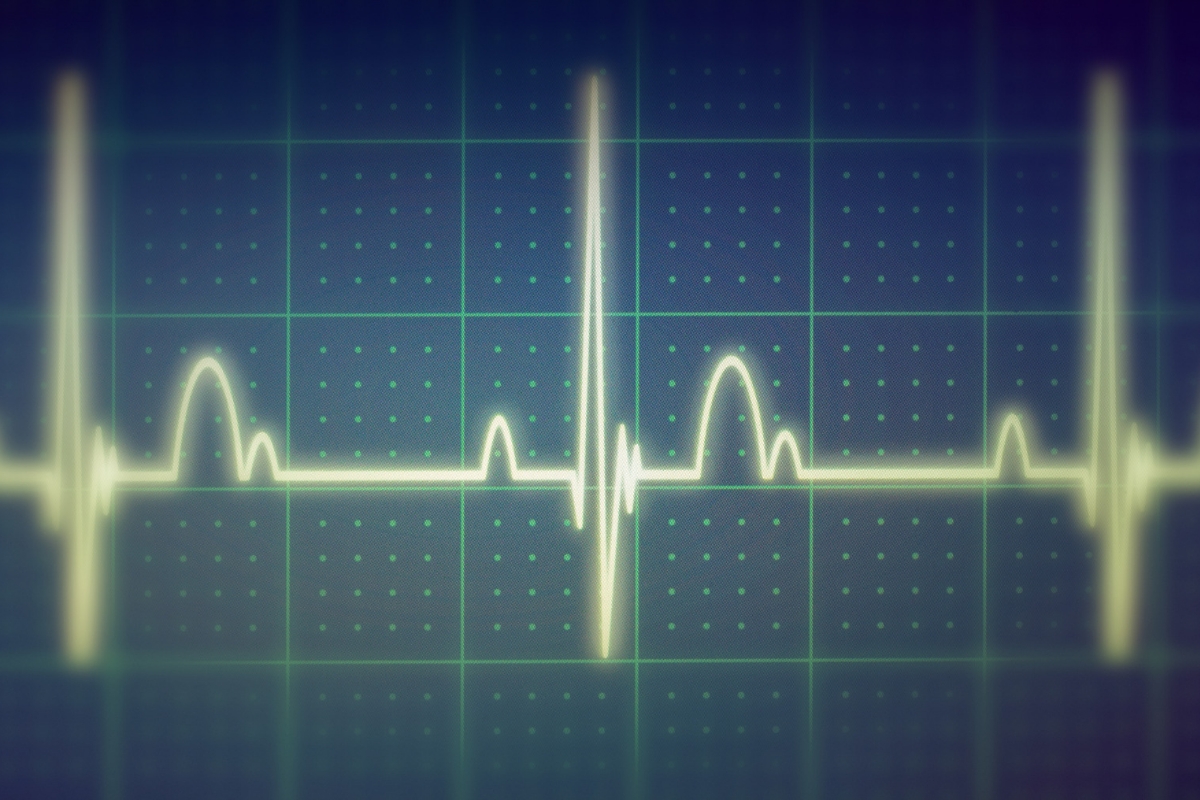 Telecardiology: Advancing Healthcare Delivery and Cardiac Care through ...